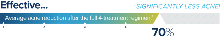 Accure Results – Accure for Acne